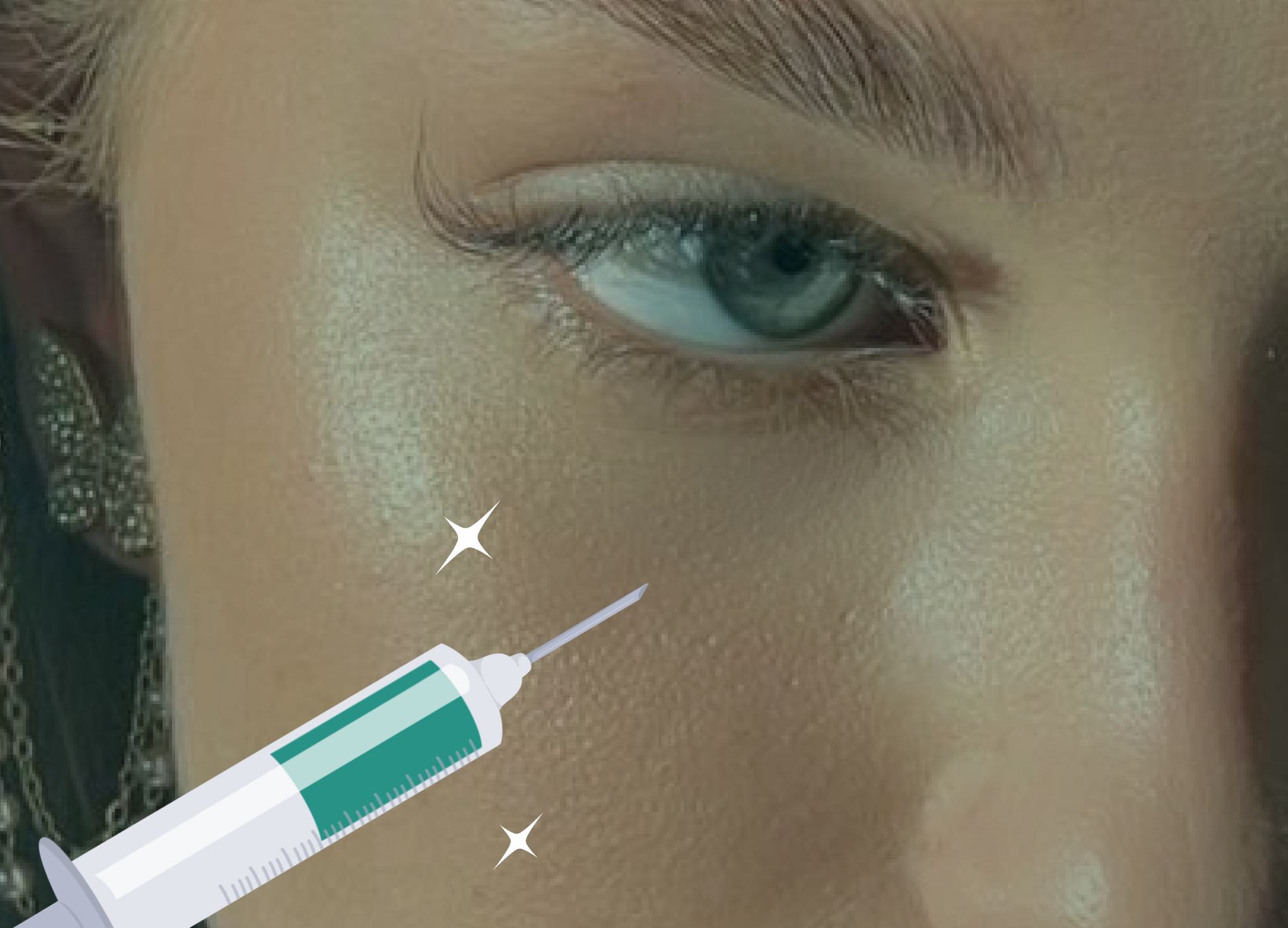 Upkeep | PRF vs Filler: Which is Better for Undereyes?