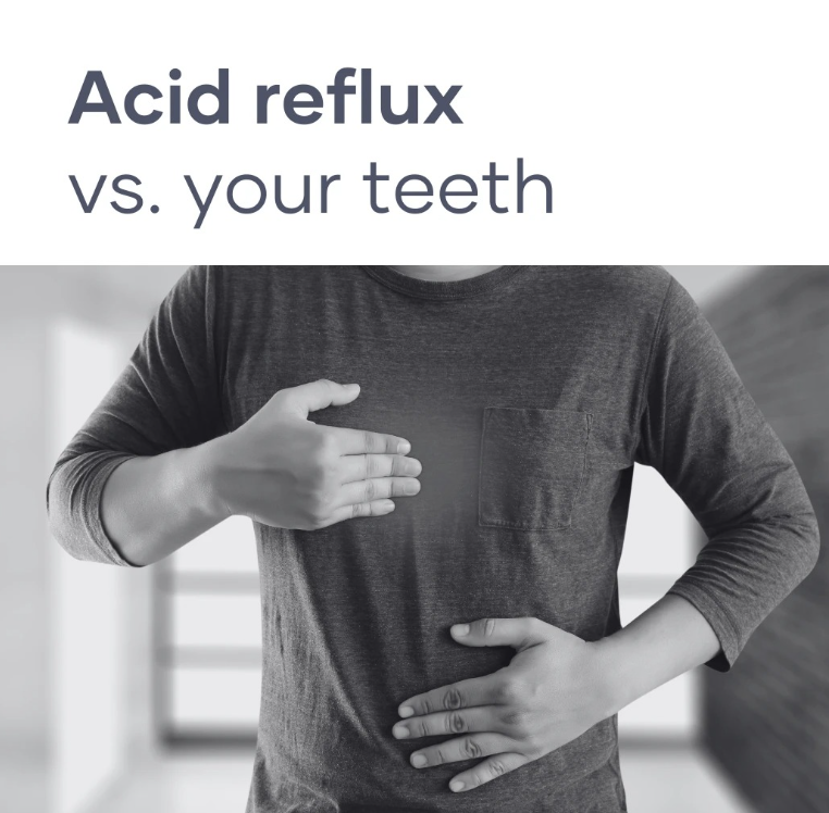Acid reflux vs. your teeth - Developer X - Webflow Ecommerce website ...