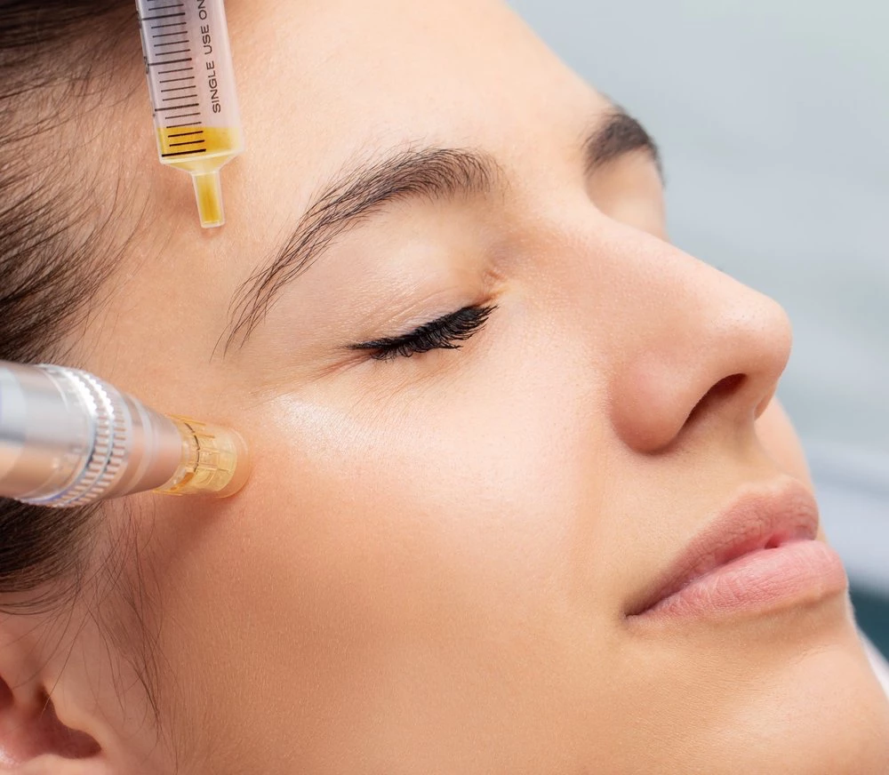 JECT Clinics | Huid | Vampire facial
