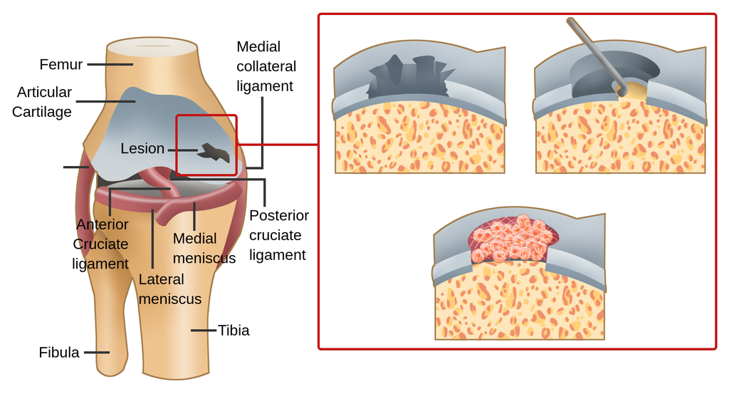 Tissue Engineering Process Diagram The Fundamental Stages Of