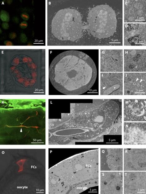 Improve Your Microbiology Lab Experiments: Tips for Avoiding Common ...