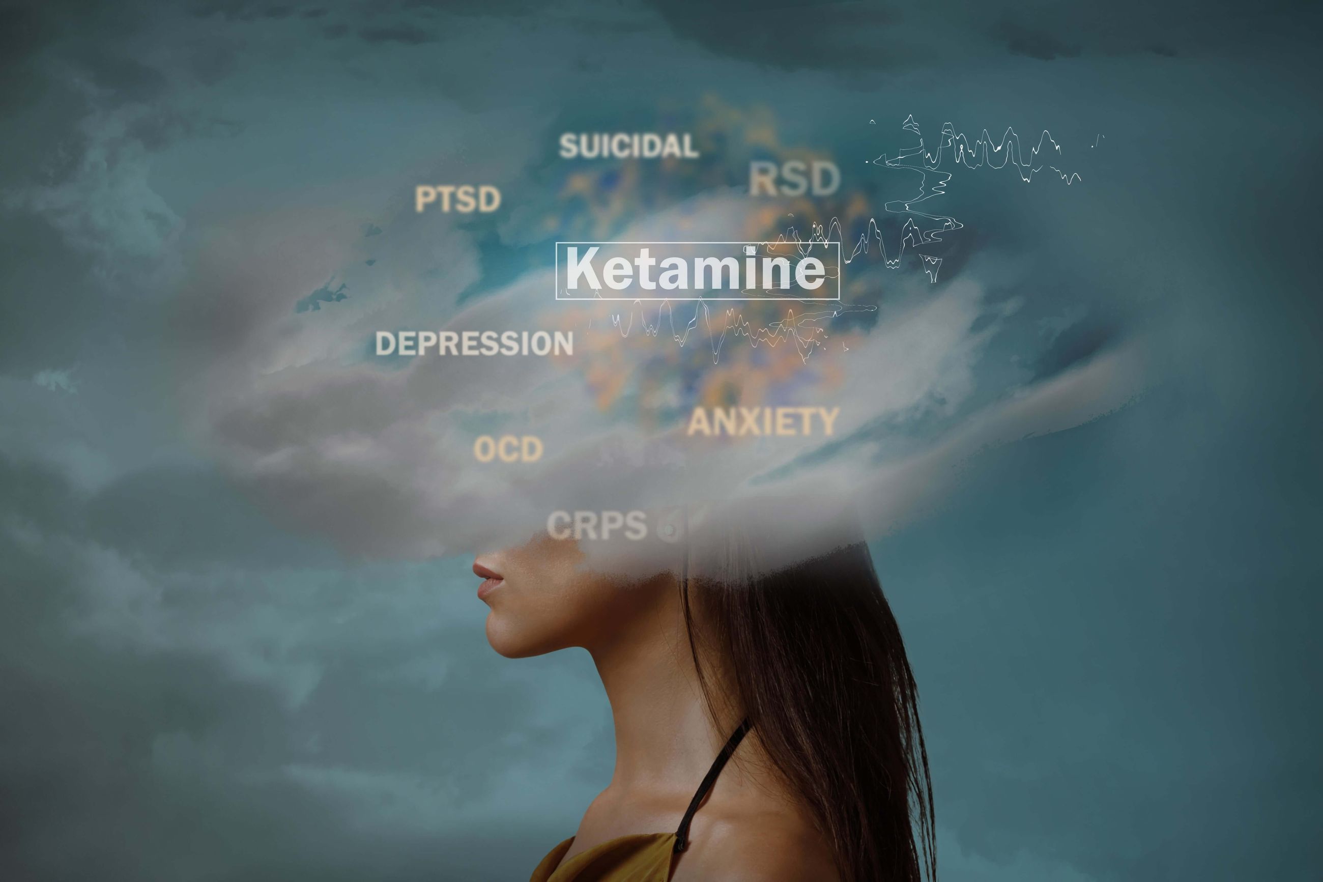 What is Low Dose Ketamine Treatment and How Does it Work?