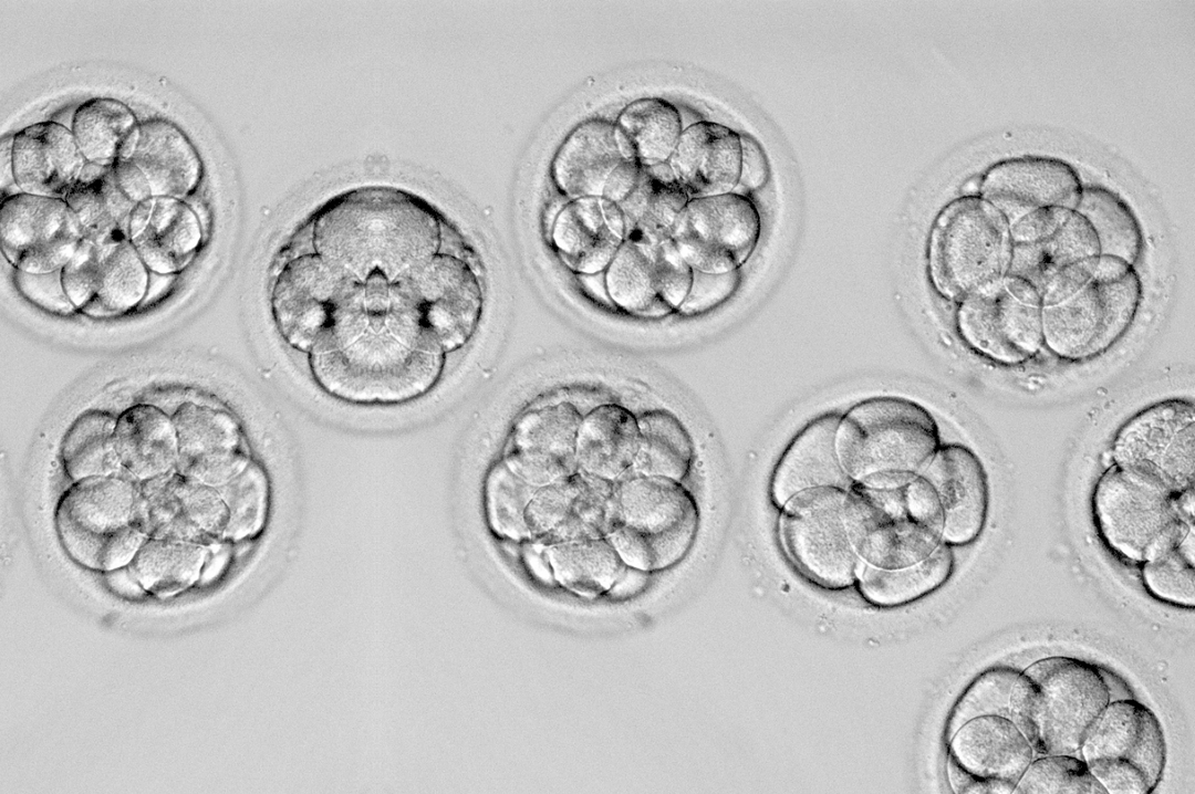 Understanding Embryo Grading: What It Means, Why It Matters, and How to ...