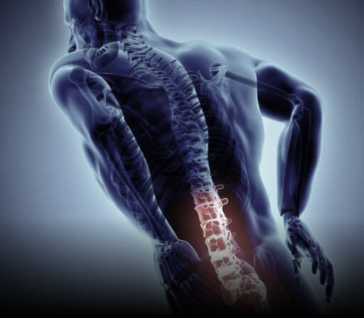 Neurological Spine Surgery | Royal Spine Surgery