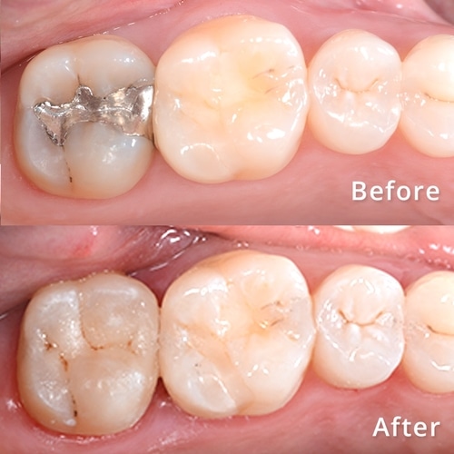 Home | Brisbane Prosthodontics