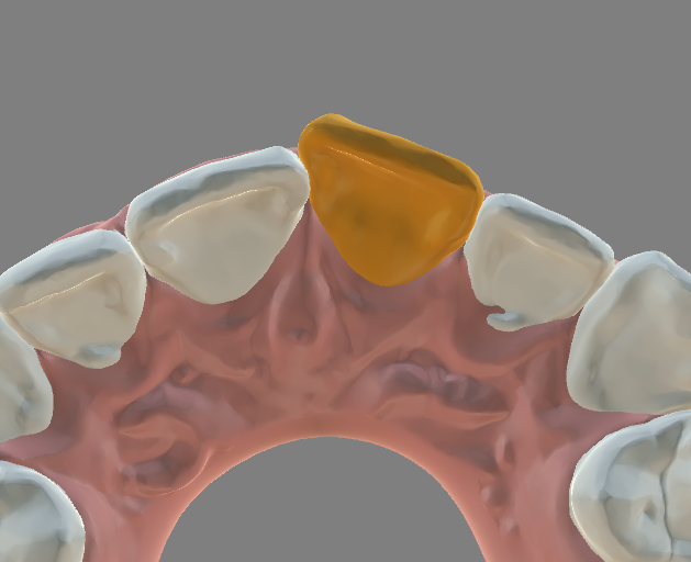 Movimientos dentarios | FuturaLabs
