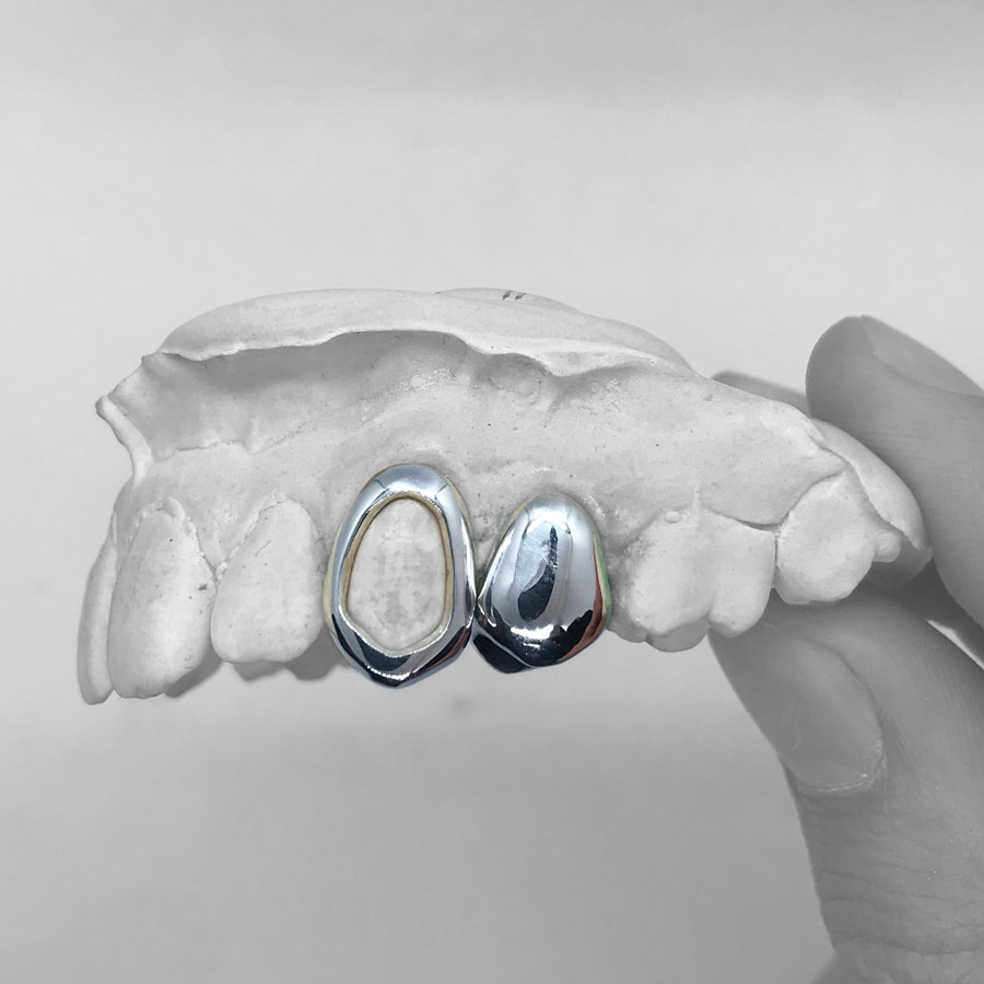 Window and cap | Pearl Set Studio - Grillz