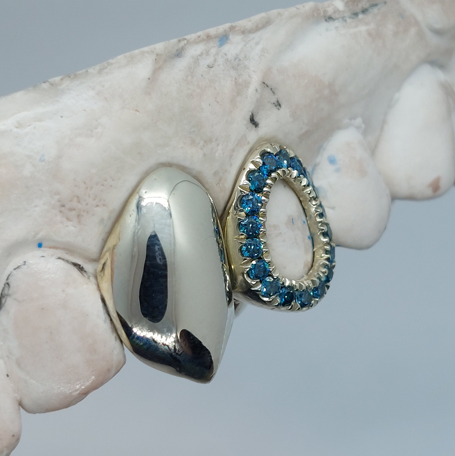 Diamond Stone Set Window and Full Cap | Pearl Set Studio - Grillz