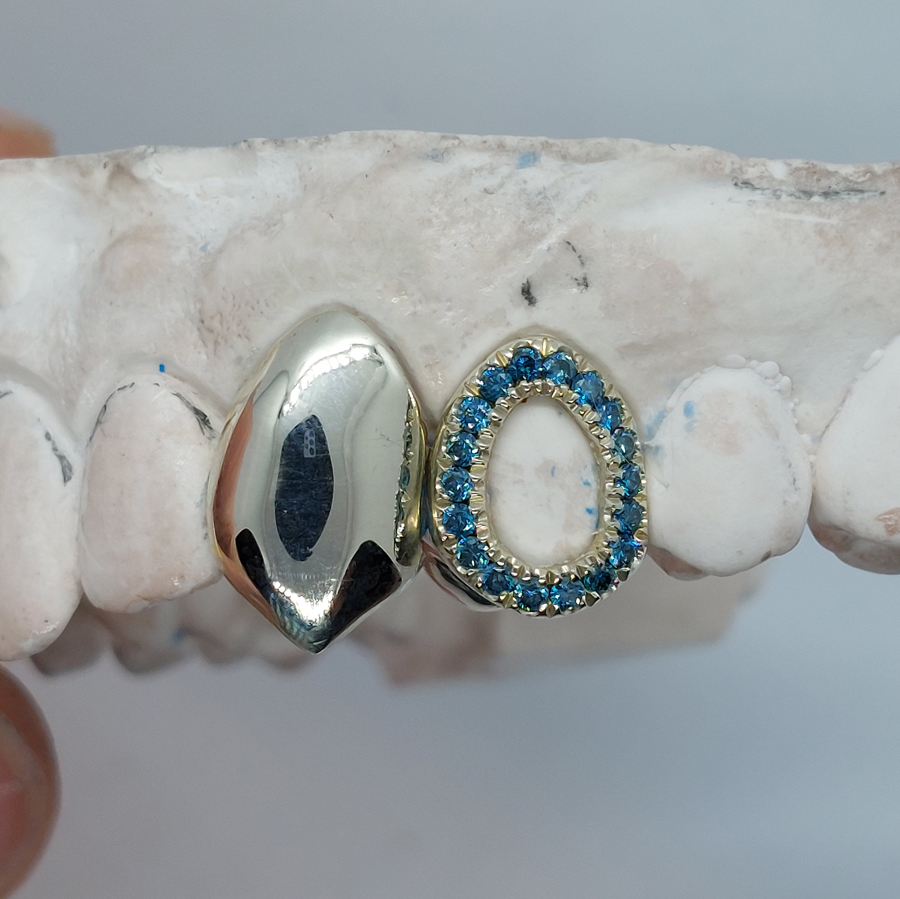 Diamond Stone Set Window and Full Cap | Pearl Set Studio - Grillz