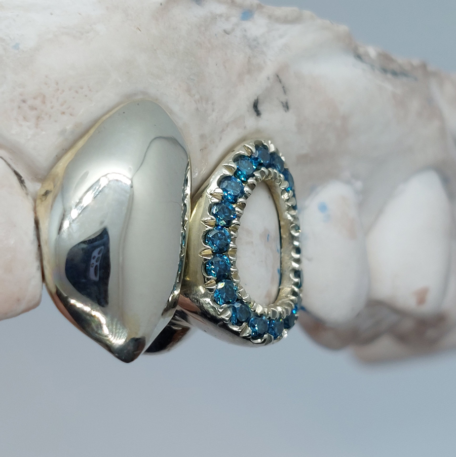 Diamond Stone Set Window and Full Cap | Pearl Set Studio - Grillz