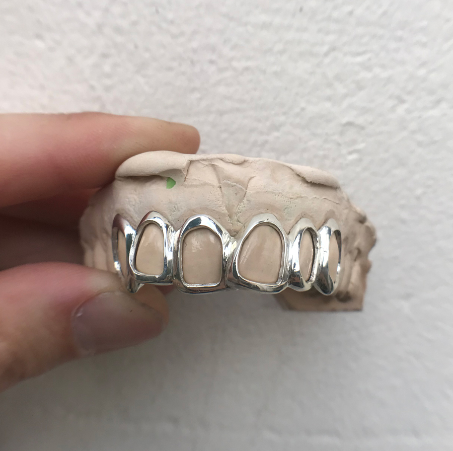 Window 6 Set | Pearl Set Studio - Grillz