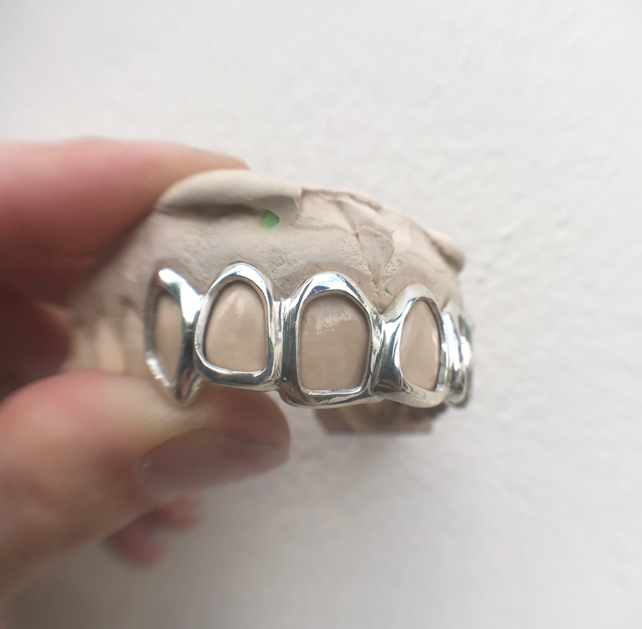 Window 6 Set | Pearl Set Studio - Grillz