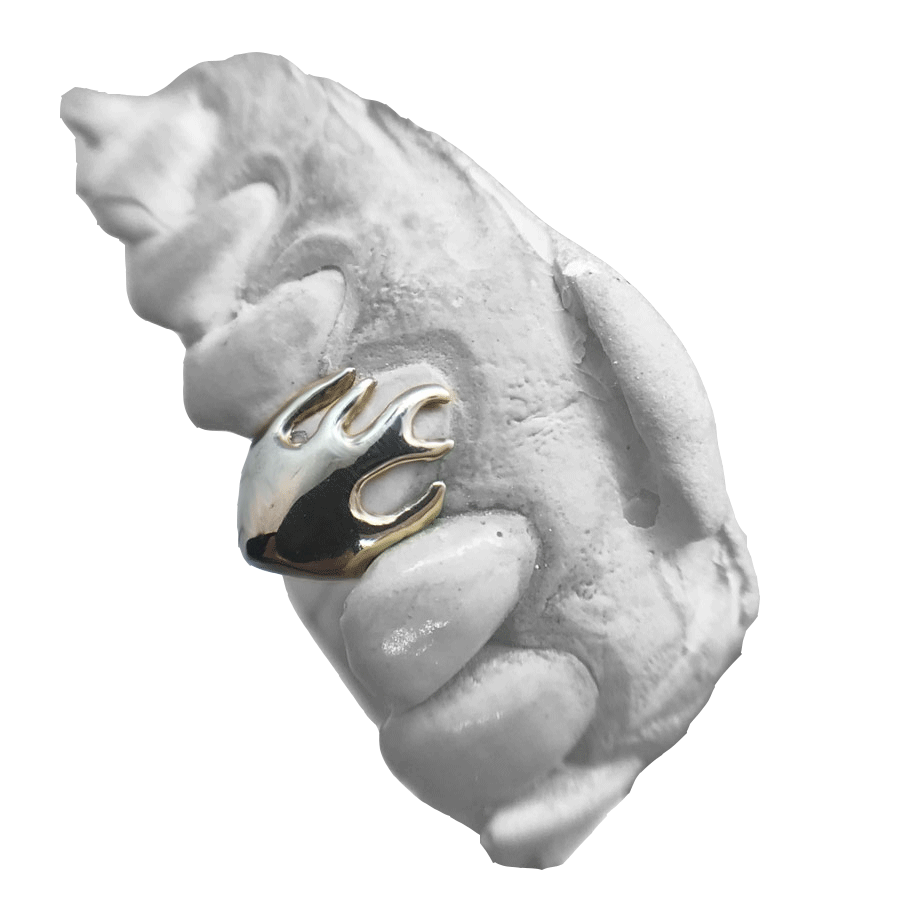 Skull Grill | Pearl Set Studio - Grillz