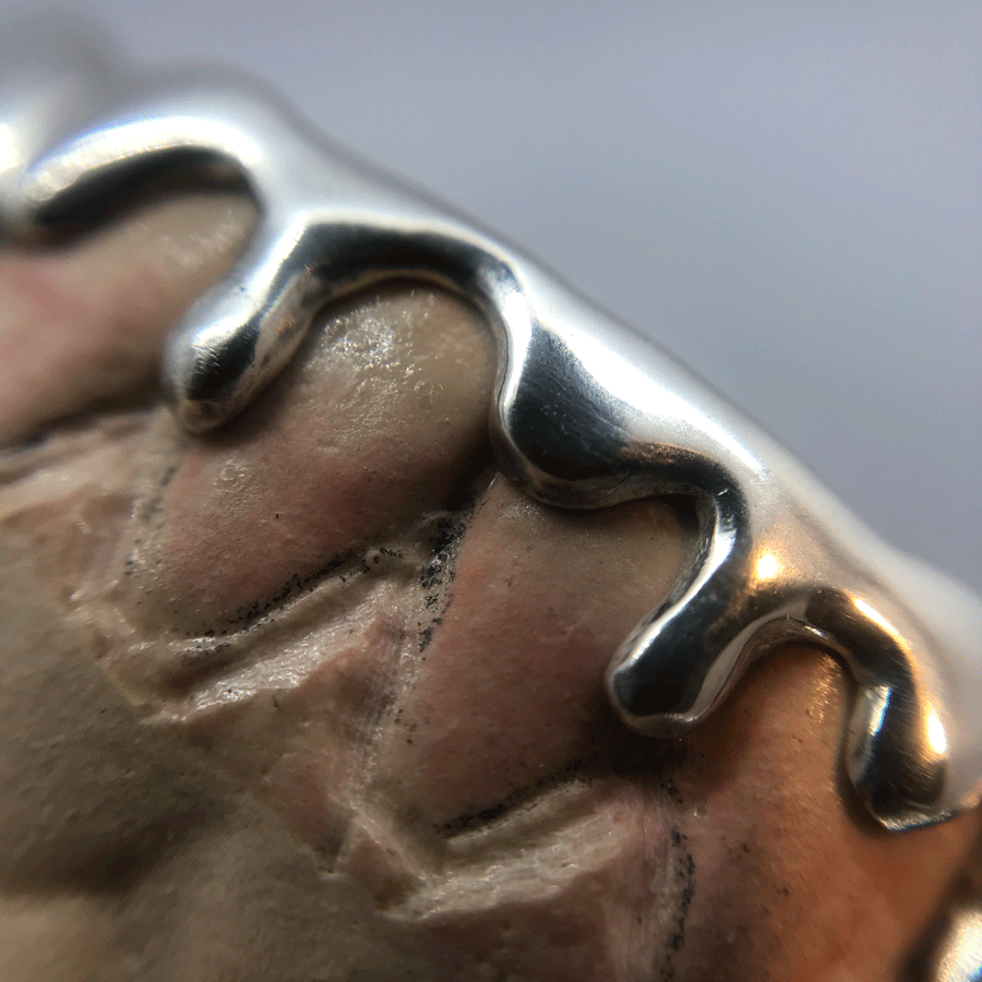 Drippy 6 Set | Pearl Set Studio - Grillz