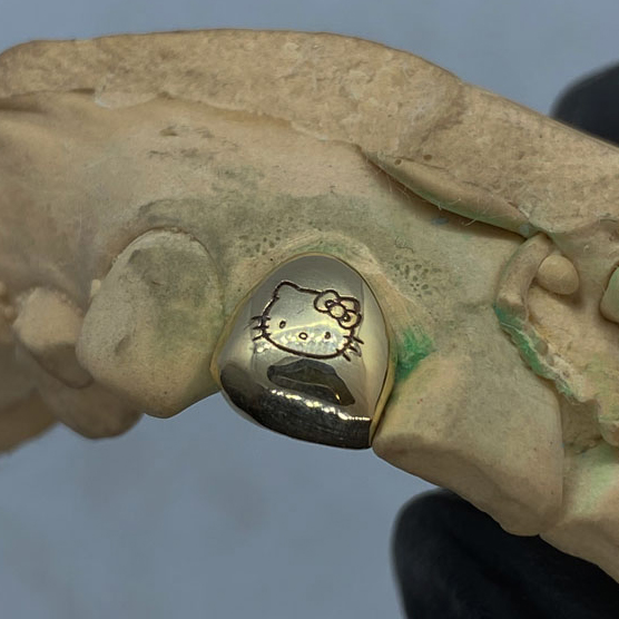 Lazer Engraved Cap | Pearl Set Studio - Grillz