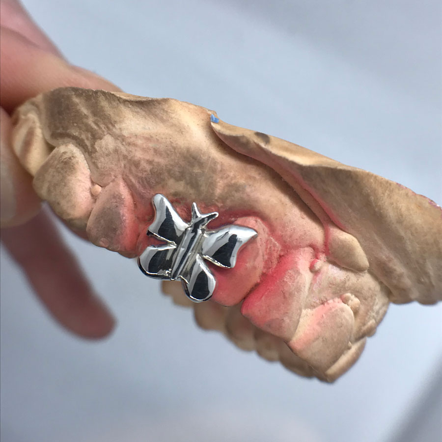 Butterfly grill | Pearl Set Studio - Grillz