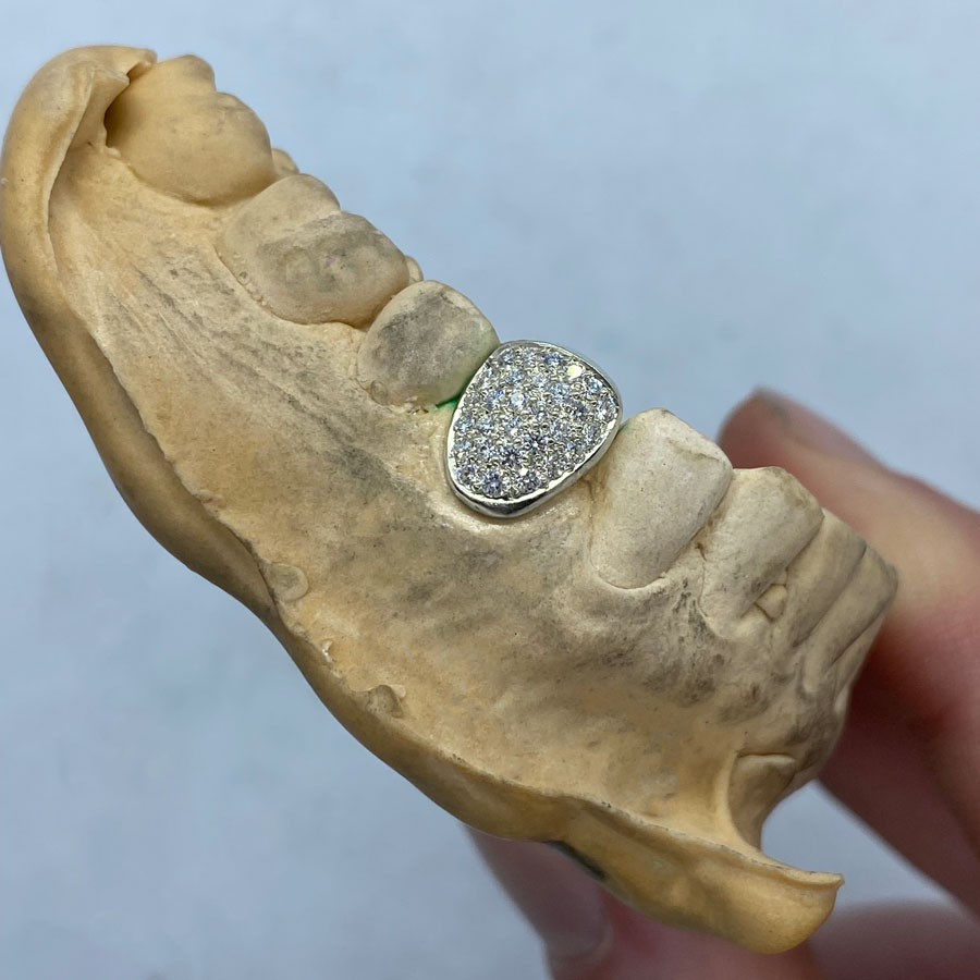 Diamond Tooth | Pearl Set Studio - Grillz