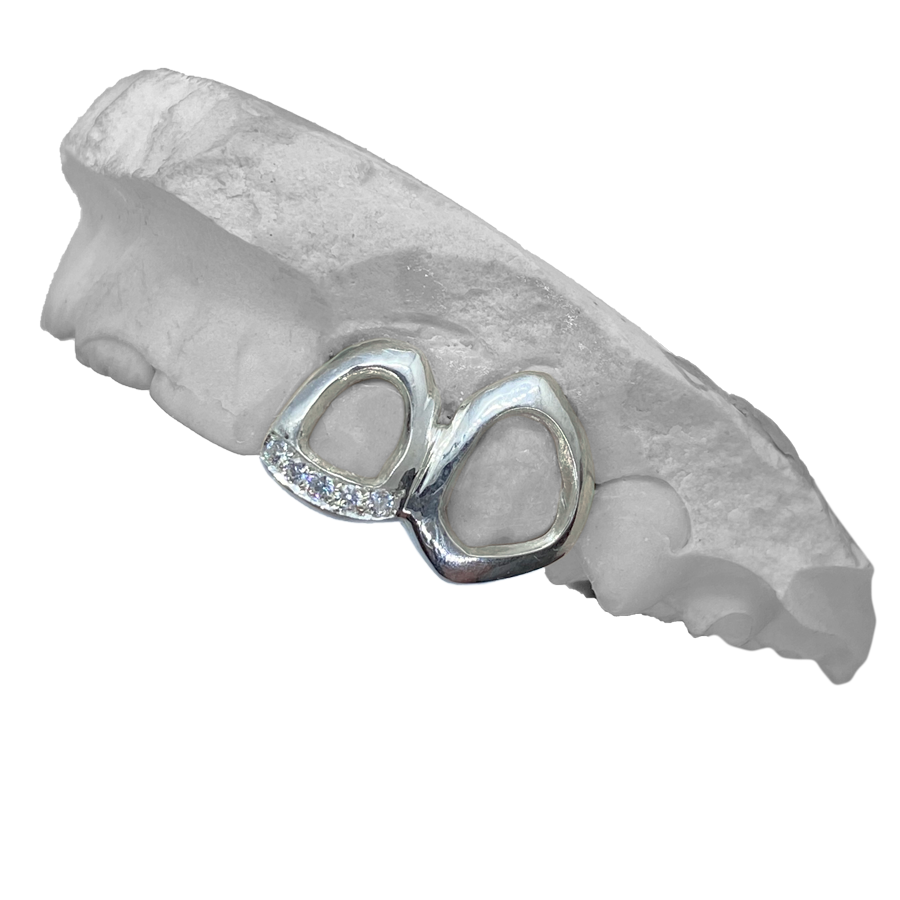 Diamond Stone Set Window and Full Cap | Pearl Set Studio - Grillz