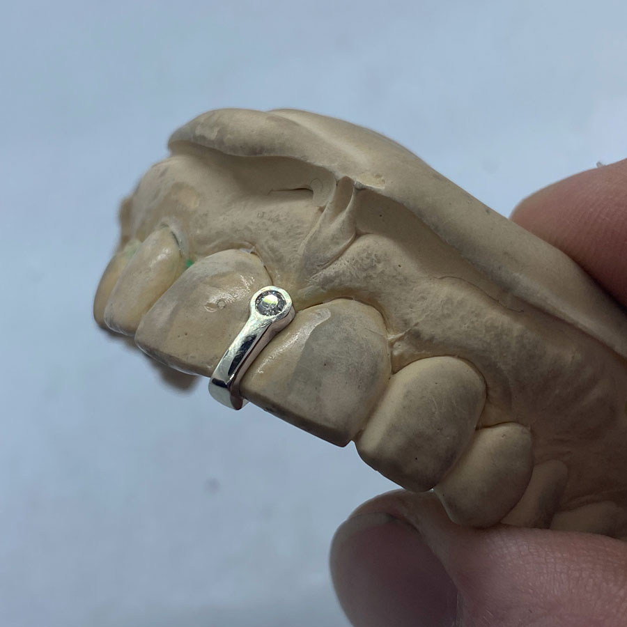 Gap filler with Stone | Pearl Set Studio - Grillz