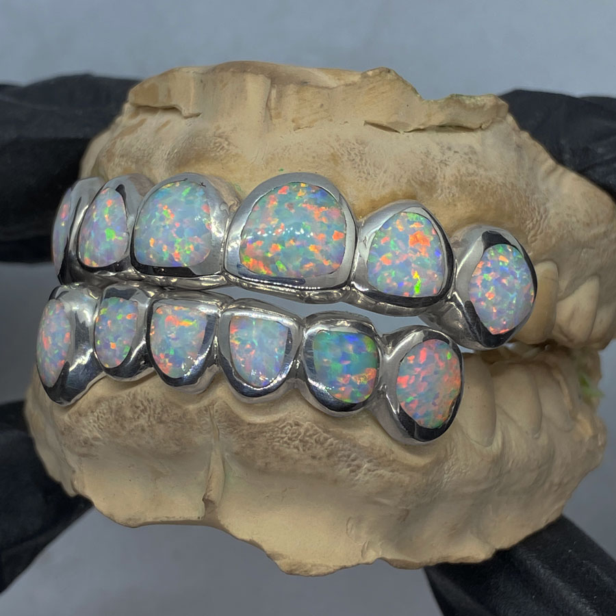 Opal Set 6 on 6 | Pearl Set Studio - Grillz