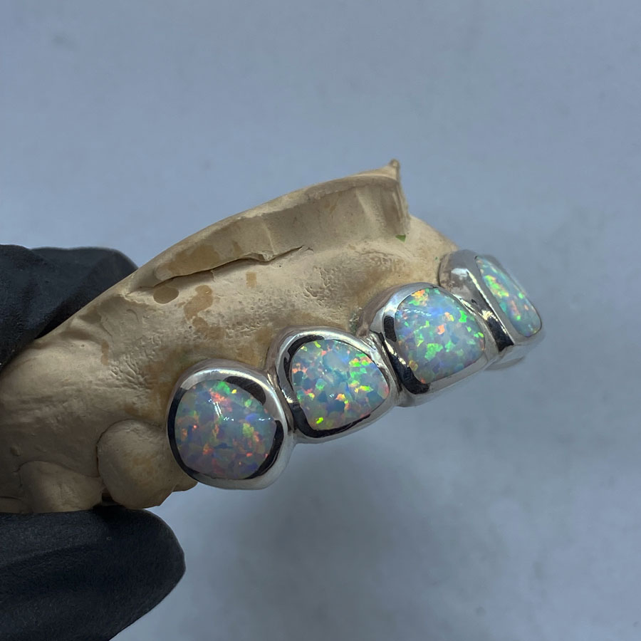 Opal Set 6 on 6 | Pearl Set Studio - Grillz
