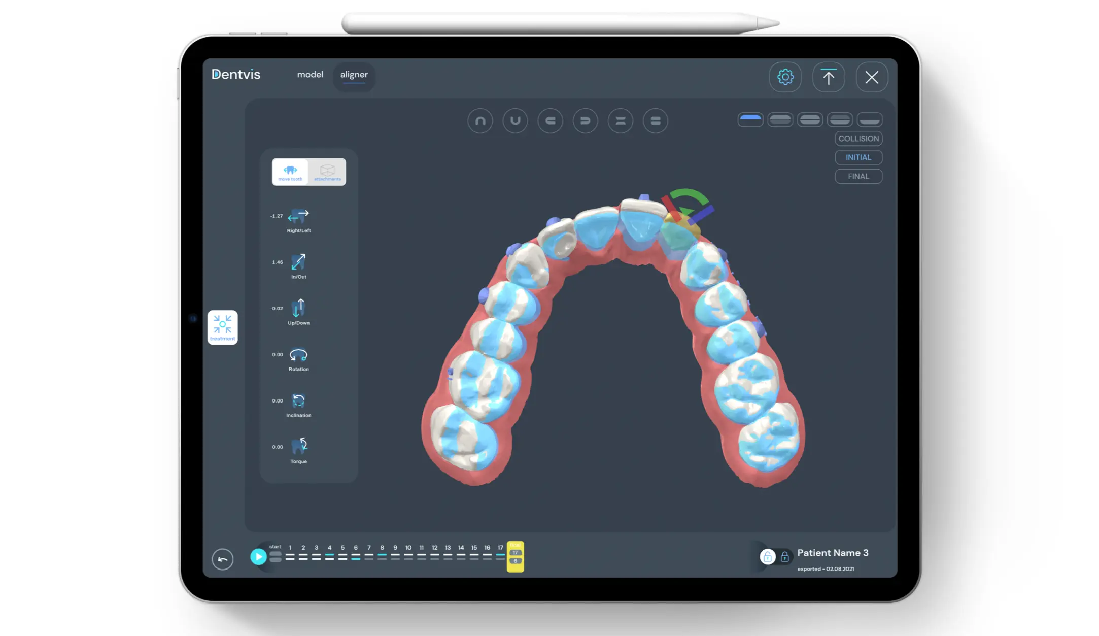What are the tricky parts in developing an application for designing ...