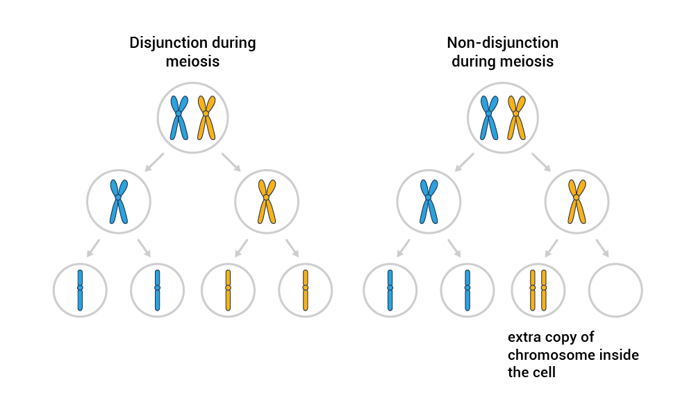 Klinefelter Syndrome Guide: Causes, Symptoms, Diagnosis, Treatment