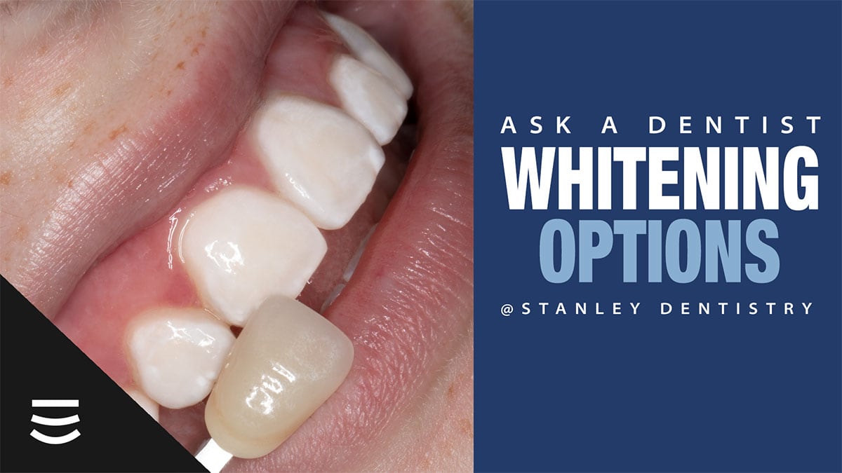 Teeth Whitening: What are my Options? | Stanley Dentistry