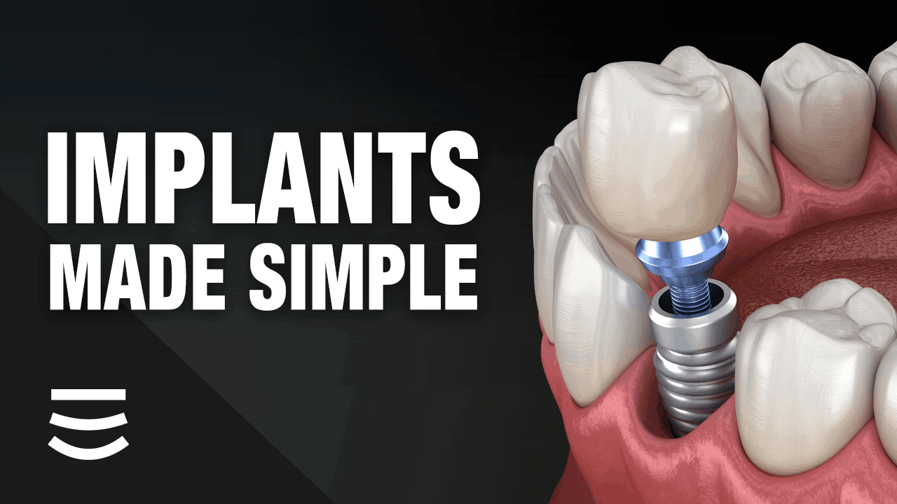 Simple Single Implant Testimony | Stanley Dentistry