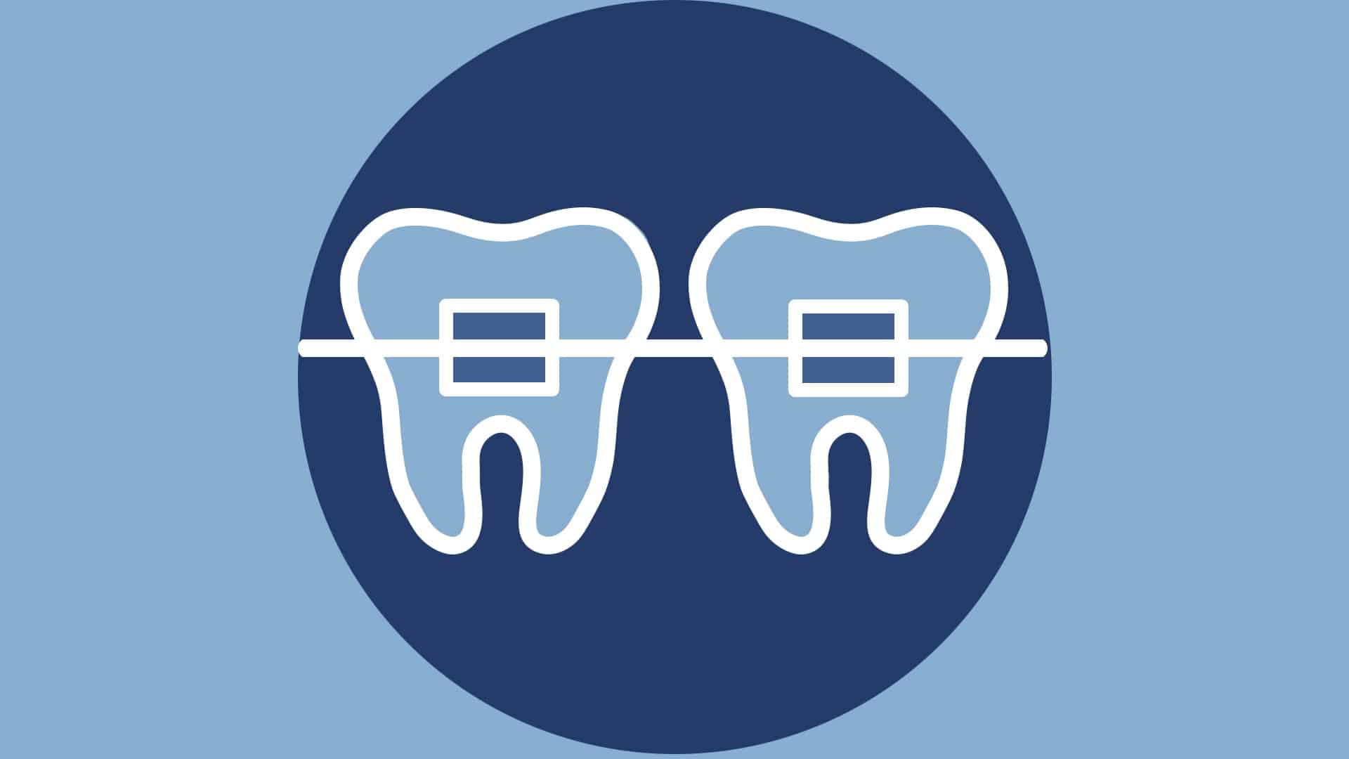 How Do Braces Work? | Stanley Dentistry
