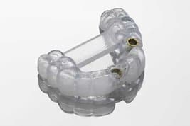 What are "Guided" Dental Implants? | Stanley Dentistry