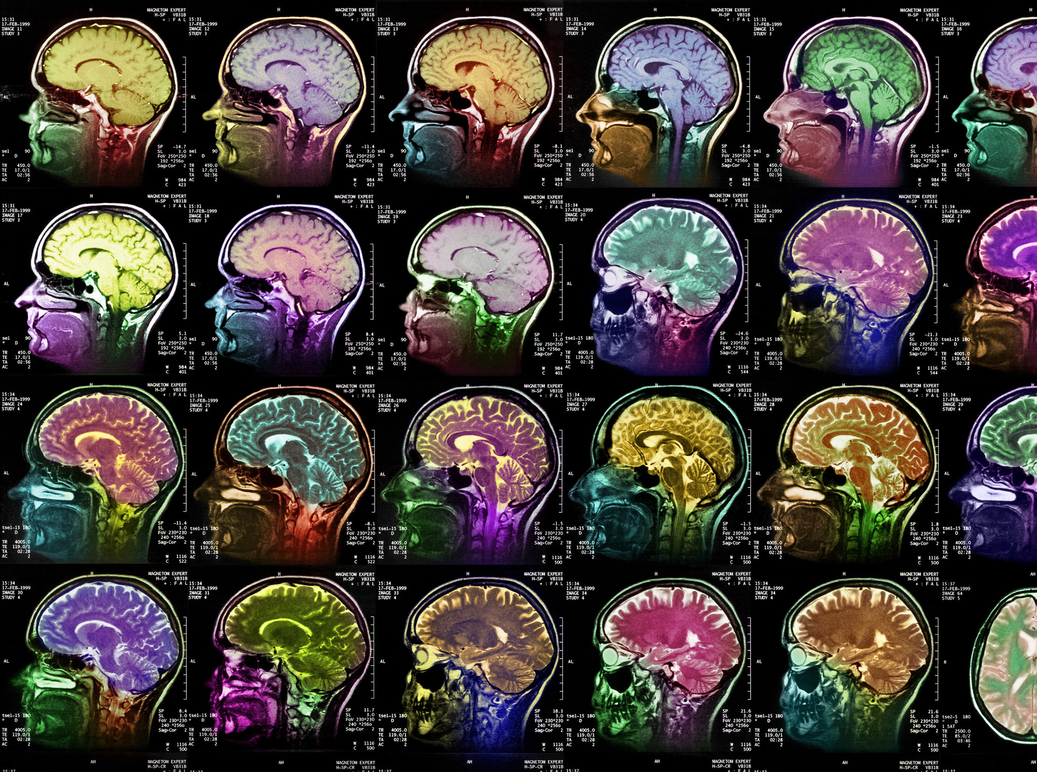 BrainSpan at ProActive Health