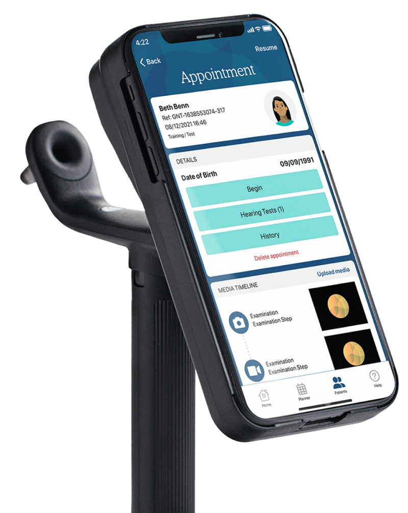 ClearEars by Resonate | Ear Cleaning & Ear Wax Removal