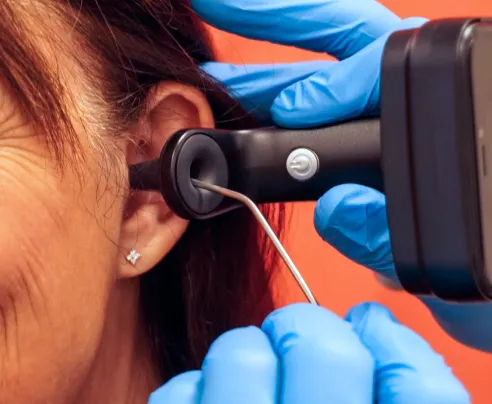 ClearEars by Resonate | Ear Cleaning & Ear Wax Removal