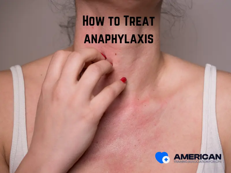 How To Treat Anaphylaxis First Aid – LQNUN