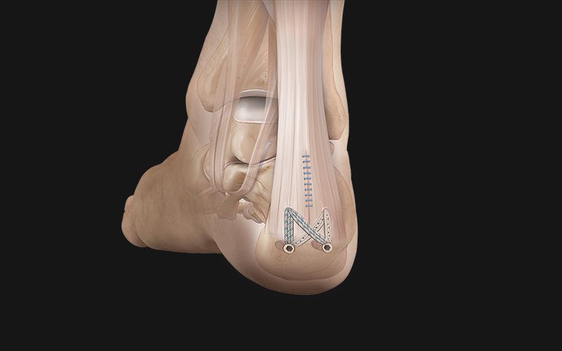 Medical Education - ArthroAcademy | Arthrex UK