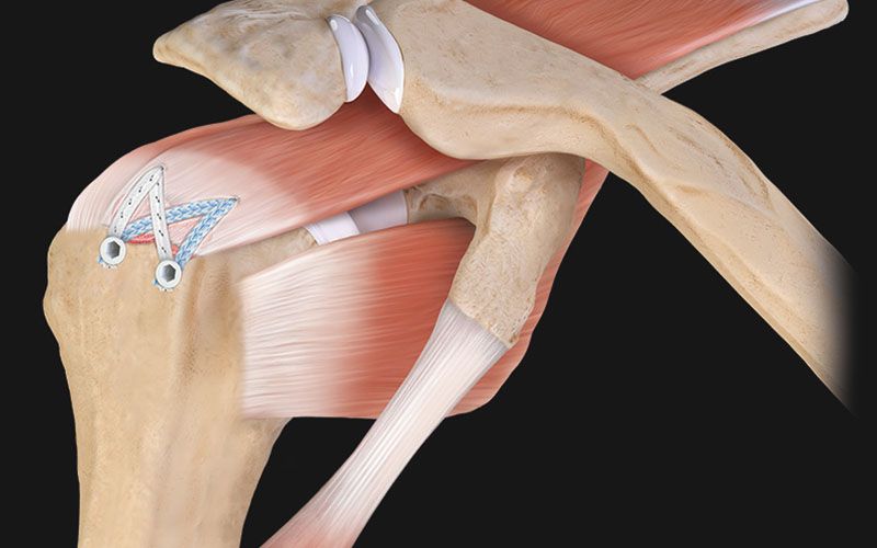 Medical Education - ArthroAcademy | Arthrex UK