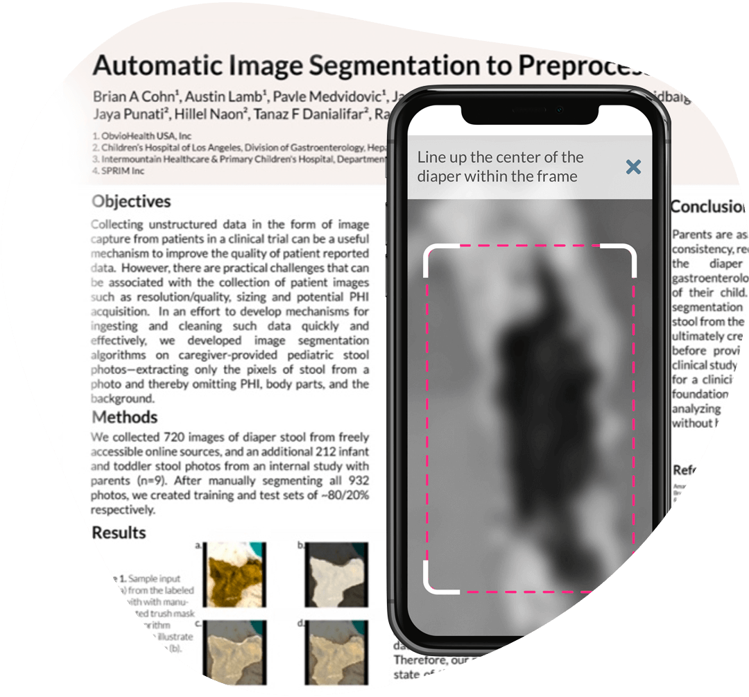 Automatic Image Segmentation | ObvioHealth