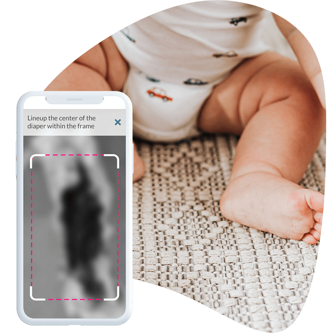 Capturing and Rating Stool Images to Evaluate GI Tolerability Case Study