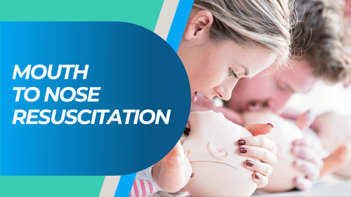 Mouth-to-Nose Resuscitation: Effective Techniques and Step-by-Step Guide