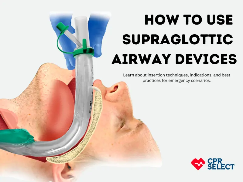 How to Use Supraglottic Airway Devices: Step-by-Step Guide