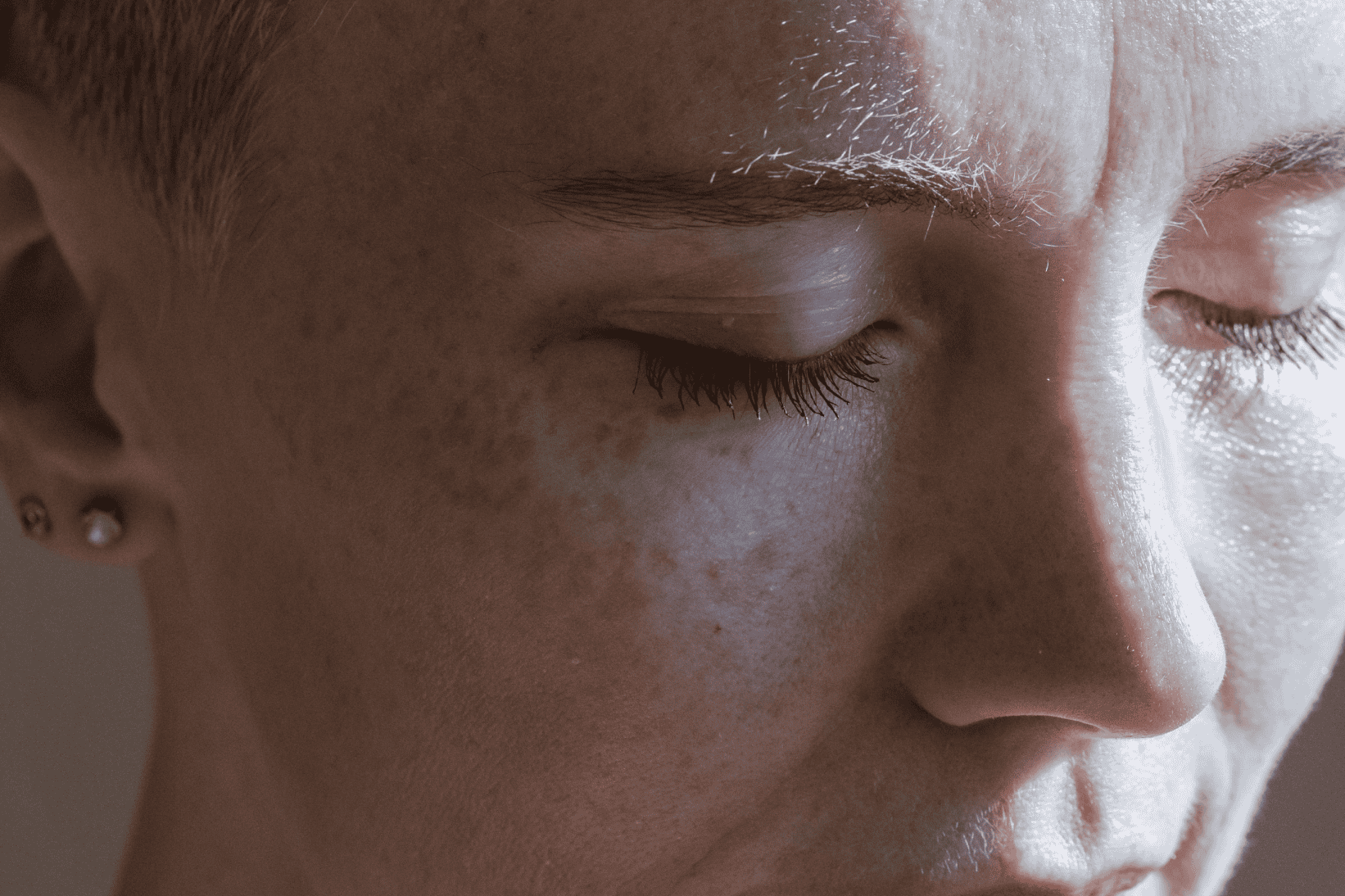 Facial Eczema | Tend UK
