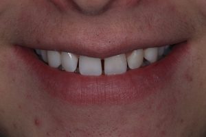 Award-winning general and cosmetic dentists in London | Freshdental ...