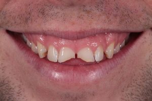 Award-winning general and cosmetic dentists in London | Freshdental ...