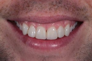 Award-winning general and cosmetic dentists in London | Freshdental ...