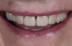 Award-winning general and cosmetic dentists in London | Freshdental ...