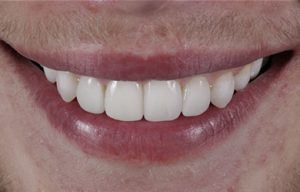 Award-winning general and cosmetic dentists in London | Freshdental ...