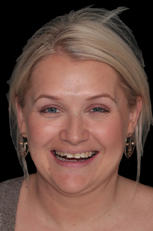 Award-winning general and cosmetic dentists in London | Freshdental ...