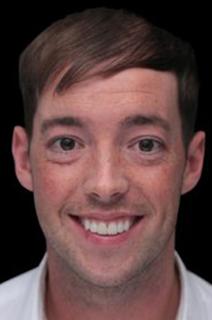 Award-winning general and cosmetic dentists in London | Freshdental ...