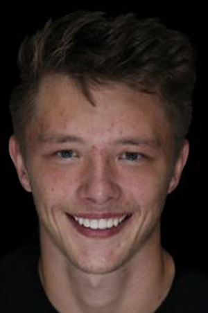 Award-winning general and cosmetic dentists in London | Freshdental ...